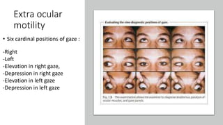 EXAMINATION OF THE EYE.pptx