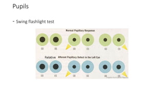 EXAMINATION OF THE EYE.pptx