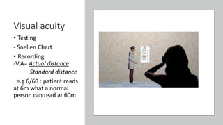 EXAMINATION OF THE EYE.pptx