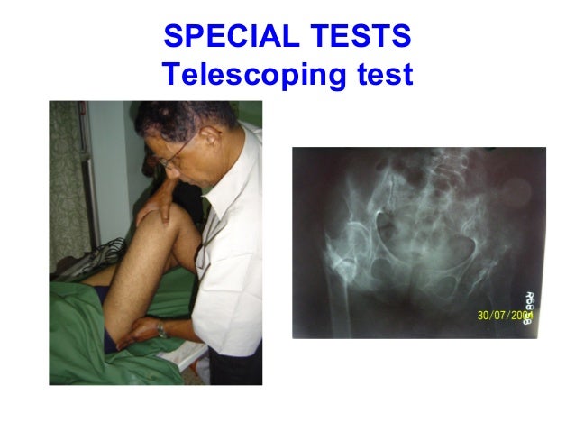 Examination of the hip