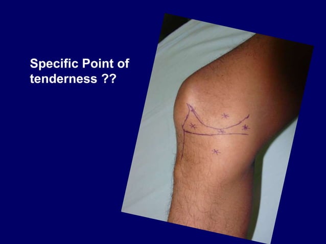 Examination_of_the_knee.ppt