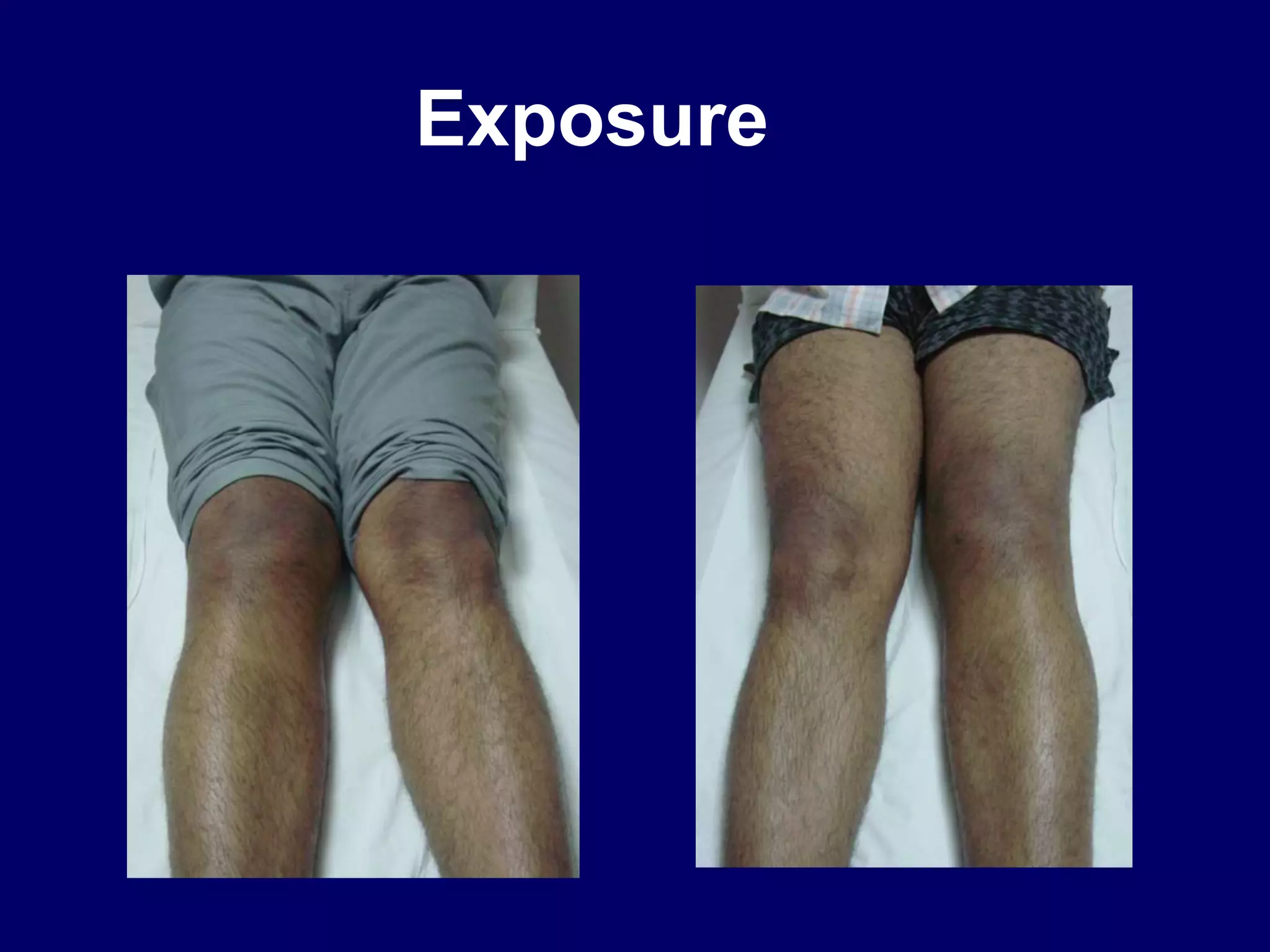 Examination_of_the_knee.ppt