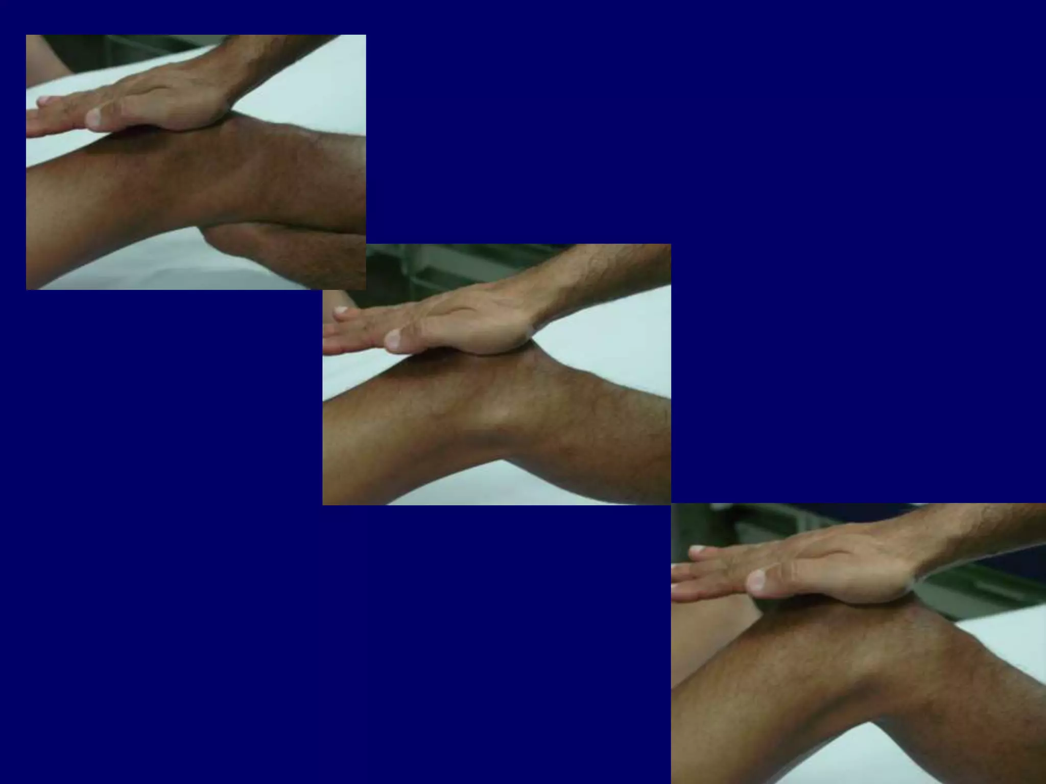 Examination_of_the_knee.ppt