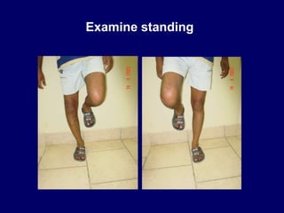 Examination_of_the_knee.ppt