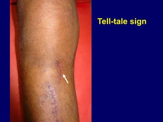 Examination_of_the_knee.ppt