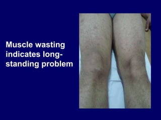 Examination_of_the_knee.ppt