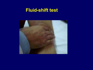 Examination_of_the_knee.ppt