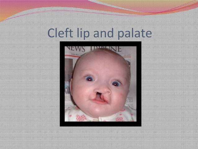 Examination of the newborn. | PPT | Pregnancy | Reproductive Health