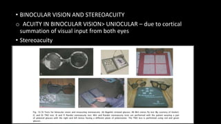 Examination of the optic nerve | PPTX
