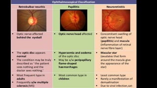 Examination of the optic nerve | PPTX