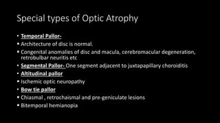 Examination of the optic nerve | PPTX