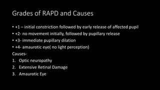 Examination of the optic nerve | PPTX