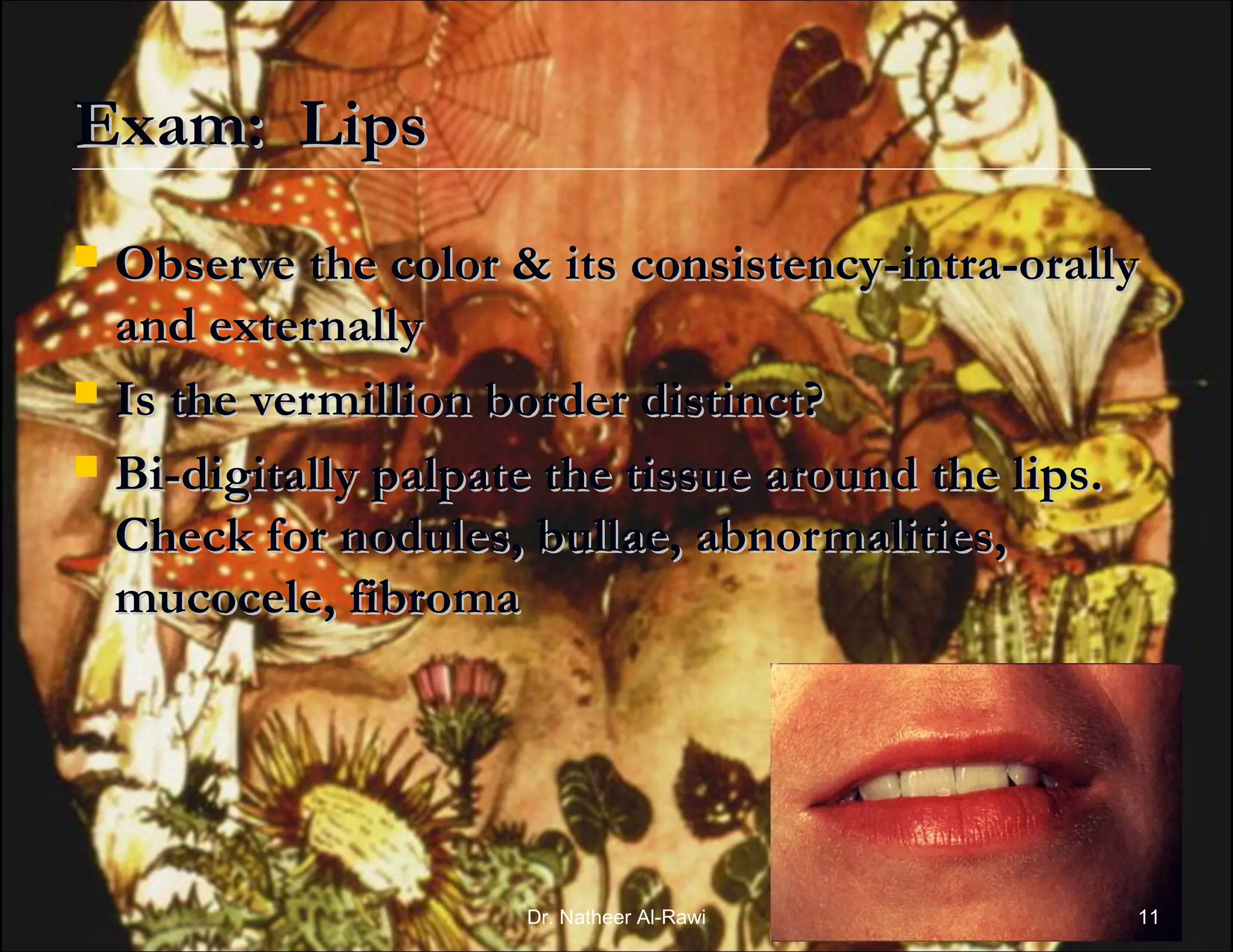 Examination of the oral cavity2 tour | PPT