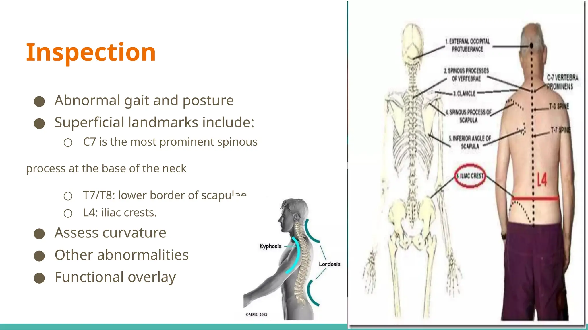 Examination of the Spine, lumps, bumps and ulcer 2.pptx