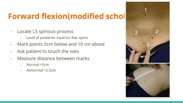 Examination of the Spine, lumps, bumps and ulcer 2.pptx