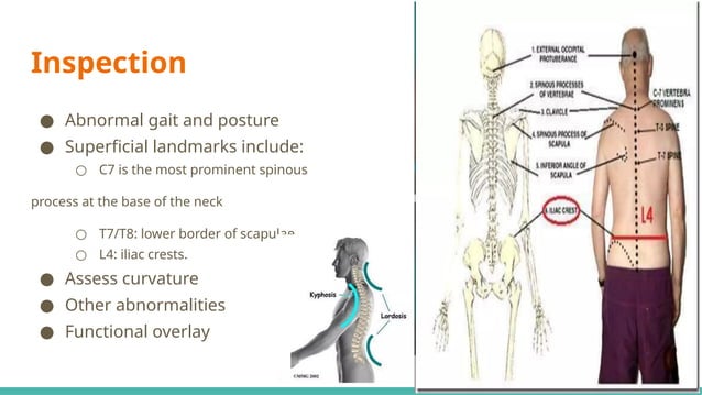 Examination of the Spine, lumps, bumps and ulcer 2.pptx