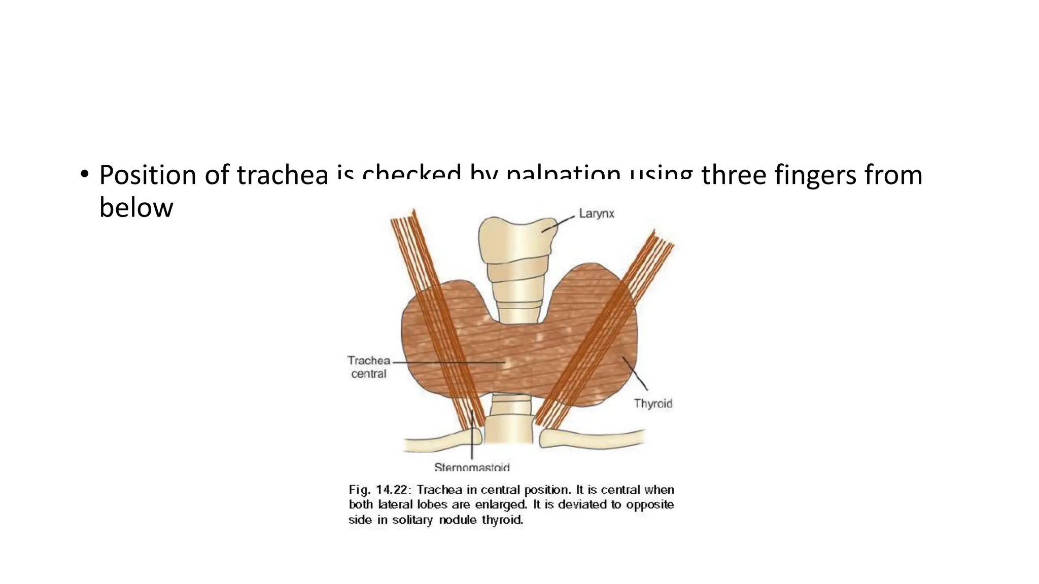 EXAMINATION OF THE THYROID Gland lecture.pptx