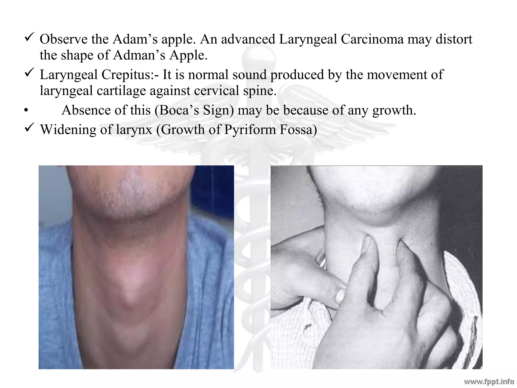 brief anatomy of larynx and its clinical evaluation | PPT