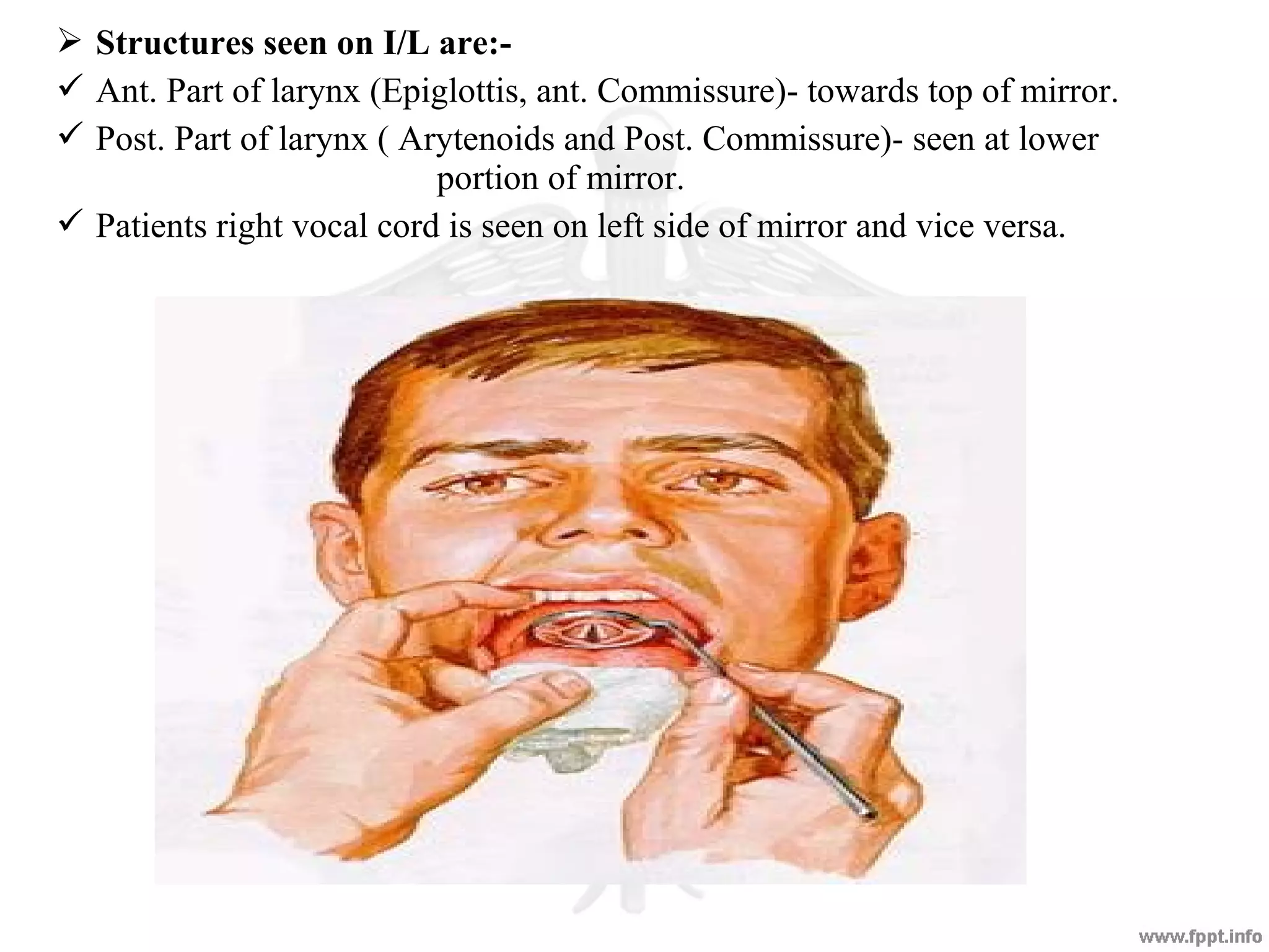 brief anatomy of larynx and its clinical evaluation | PPT