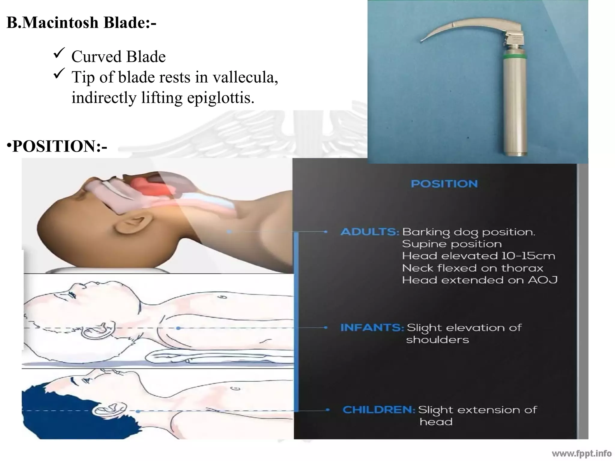 brief anatomy of larynx and its clinical evaluation | PPT