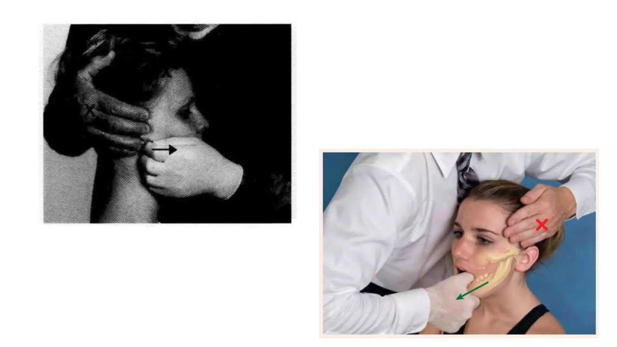 Examination of TMJ 2.pptx