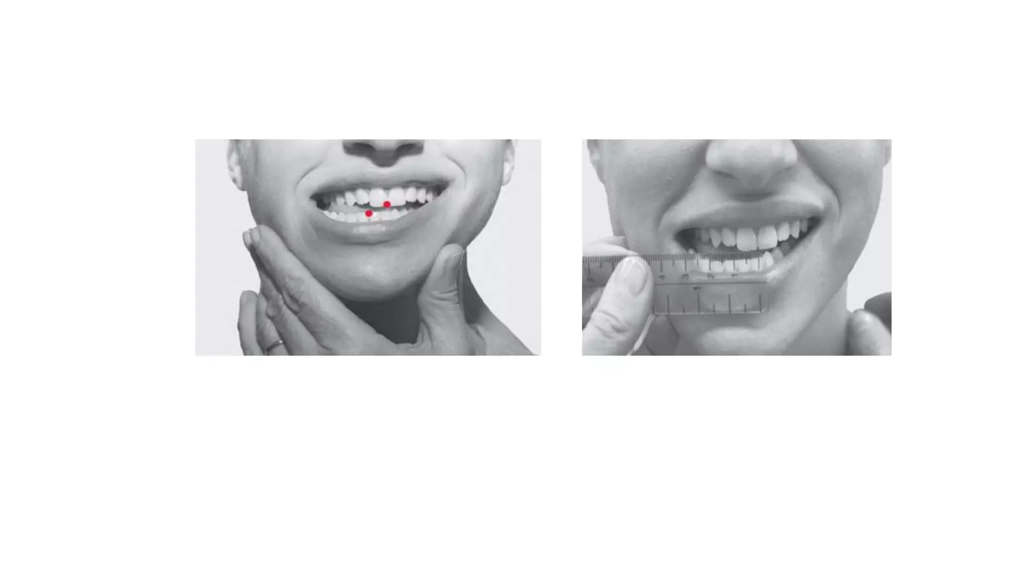 Examination of TMJ 2.pptx