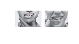 Examination of TMJ 2.pptx