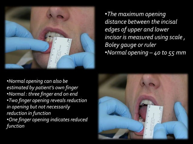 Examination of tmj &muscles of mastication (2) | PPTX