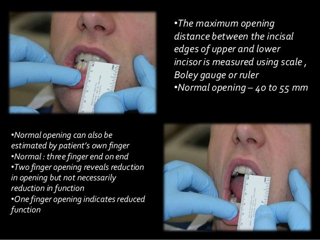 Examination of tmj &muscles of mastication (2)