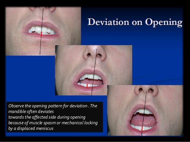 Examination of tmj &muscles of mastication (2)