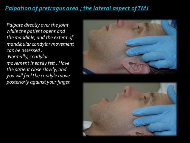 Examination of tmj &muscles of mastication (2)