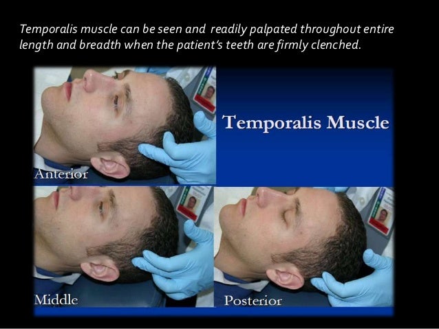 Examination of tmj &muscles of mastication (2)