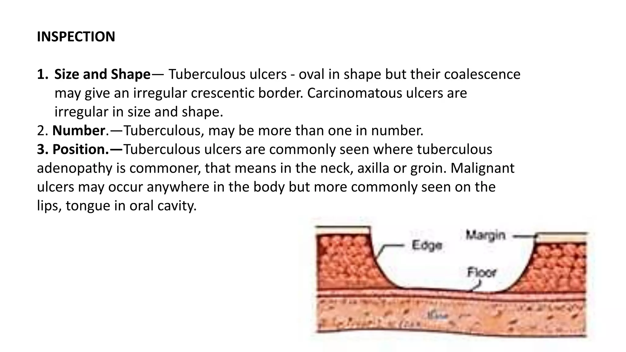 Examination of ulcer | PPTX