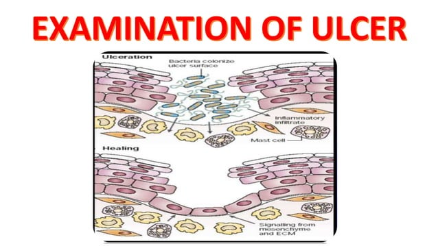 Examination of ulcer | PPTX | Skin and Dermatology | Diseases and ...