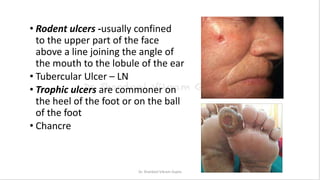 Examination of ulcer | PPTX