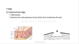 Examination of ulcer | PPTX