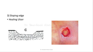Examination of ulcer | PPTX