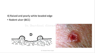 Examination of ulcer | PPTX