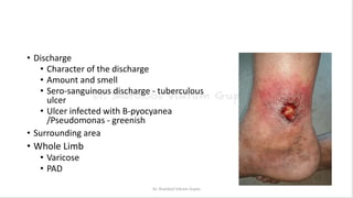 Examination of ulcer | PPTX