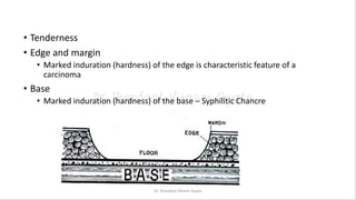 Examination of ulcer | PPTX