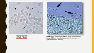 examination_of_urinary_system.pptx