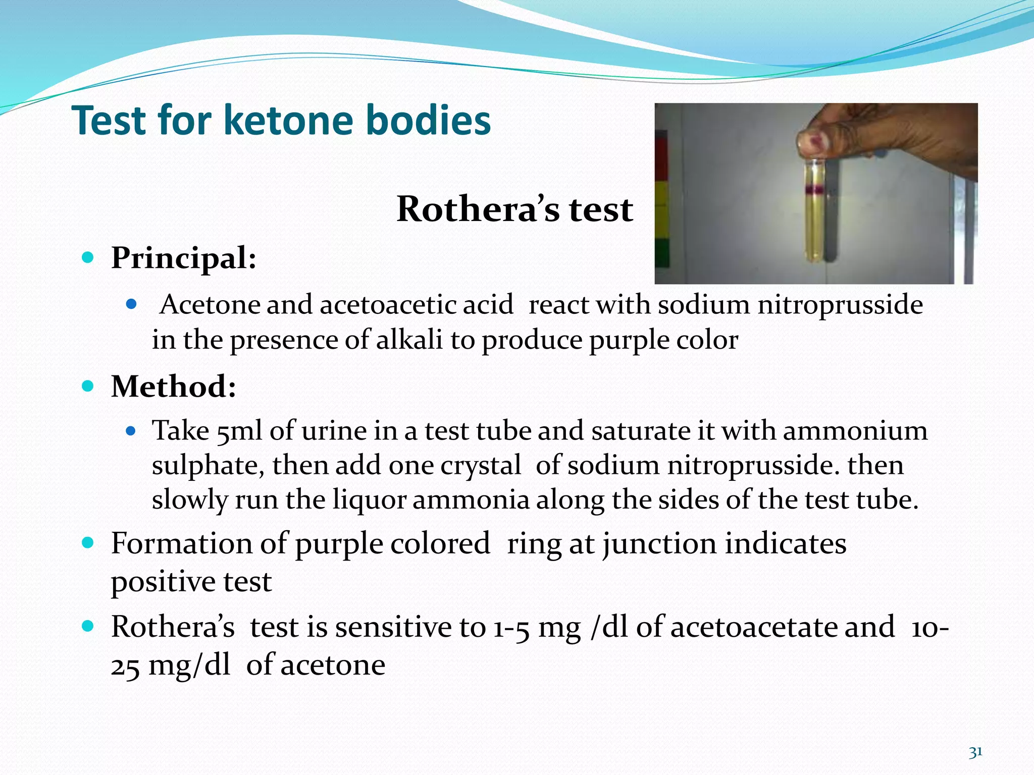 Examination of urine | PPTX