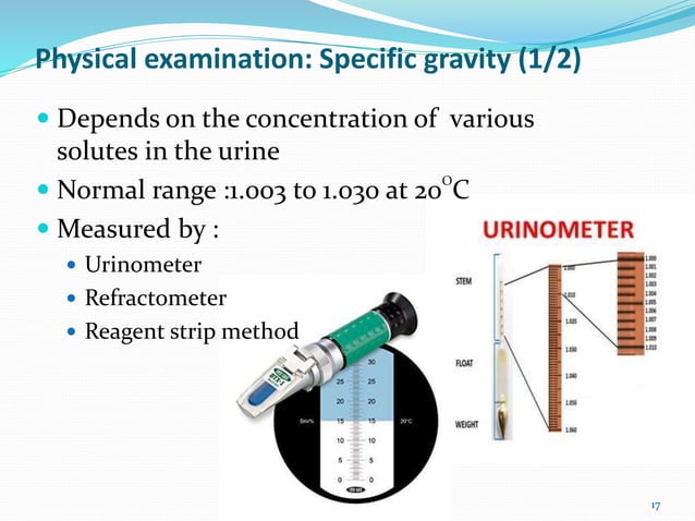 Examination of urine | PPTX