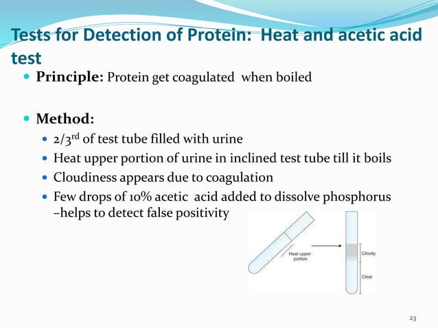 Examination of urine | PPTX