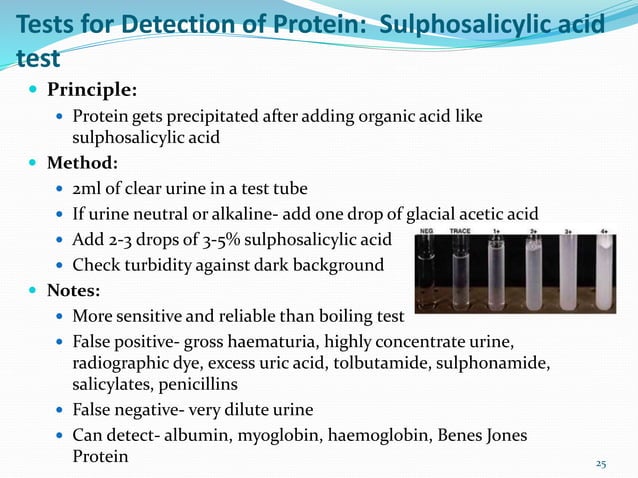 Examination of urine | PPTX