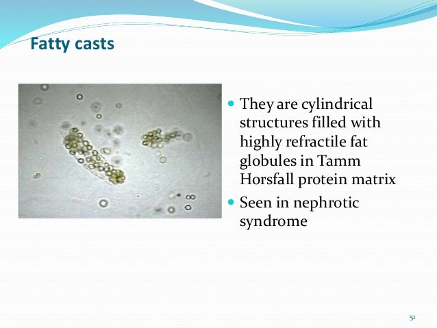 Examination of urine