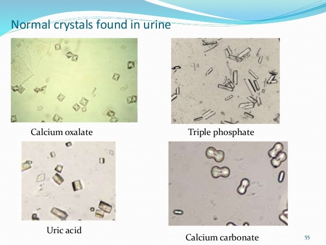 Examination of urine