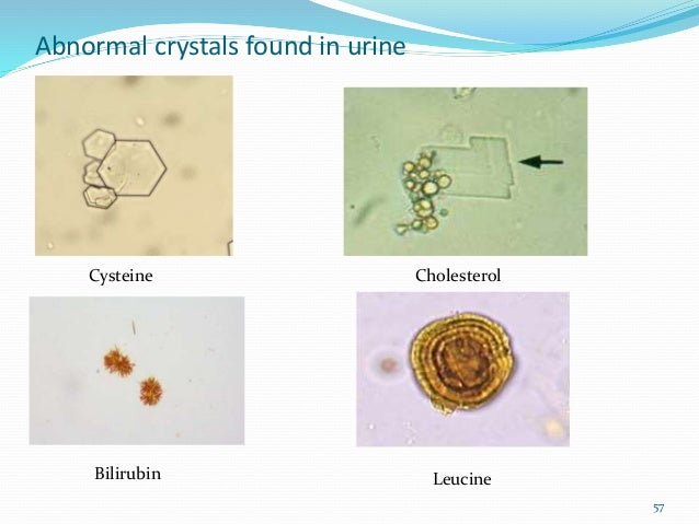 Examination of urine
