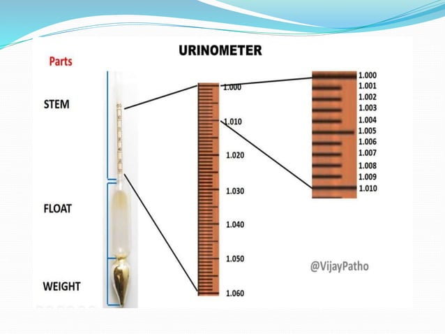 Urinalysis and test related to urine in fundamental of nursing ppt | PPT