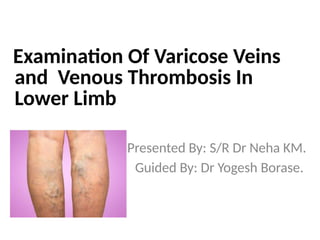 Examination Of Varicose Veins and DVT.pptx
